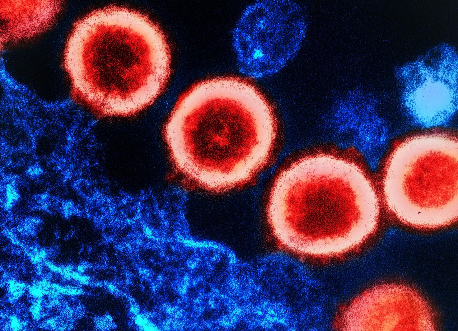 Lenacapavir: SA’s biggest breakthrough in years in fight against HIV ...